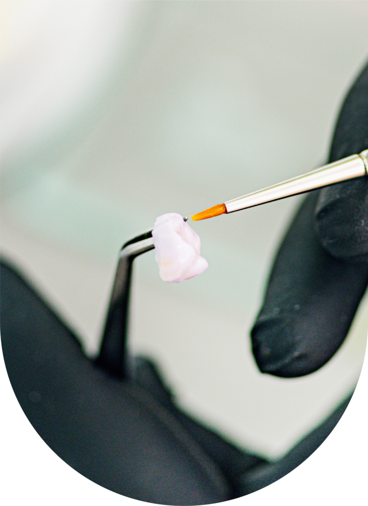 Ceramic Crowns | Dental Crowns Melbourne | CDIC